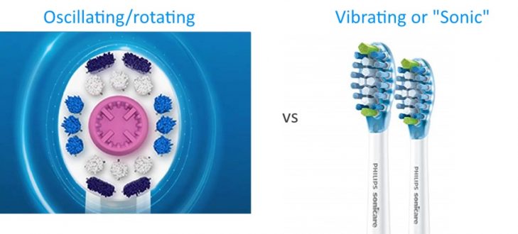 Oscillating-rotating-vs-Vibrating-sonicare-difference | Kuipers Ortho