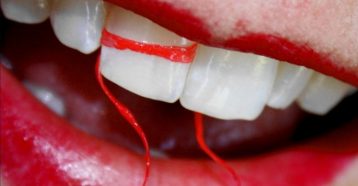 What Is Pyria? How Can It Be treated?